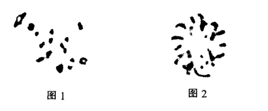 亚洲飞蝗的性别决定方式为XO型,雄性（XO，2n=23），雌性（XX，2n=24）的染色体均为端着丝粒染色体。下图是研究人员以亚洲飞蝗的精巢为 ...
